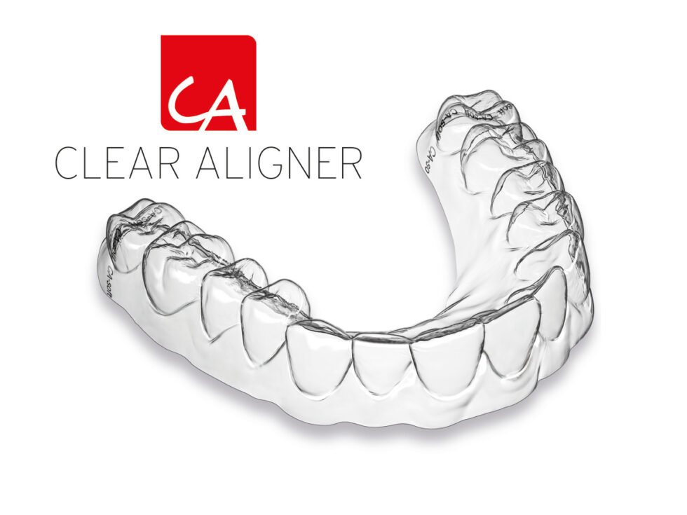 Schienentechnik - Dental Labor Trunzer
